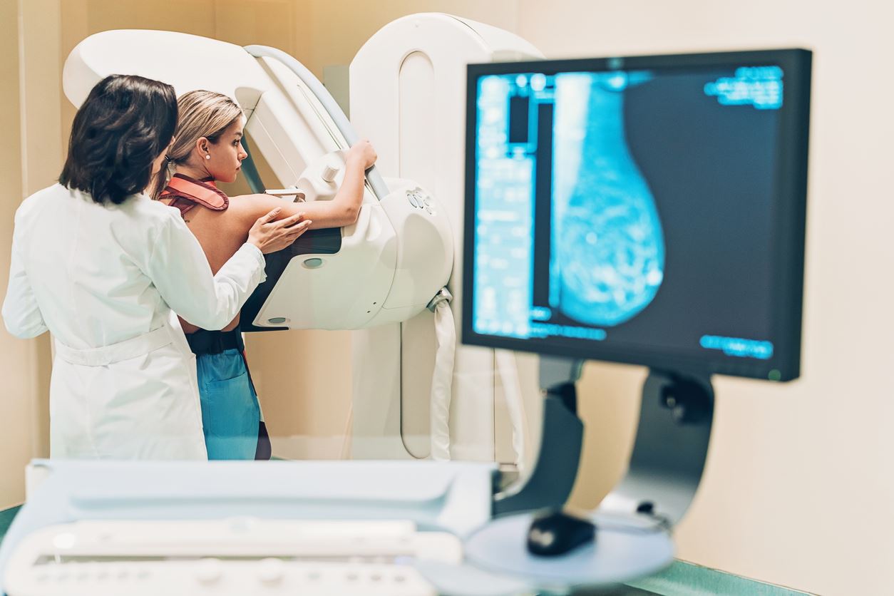 The Importance of Annual Mammograms